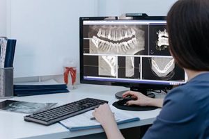 Abces tandvlees? | Lees wat je moet doen! - DENTAL365